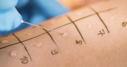 Allergia o intolleranza: quali sono le differenze?