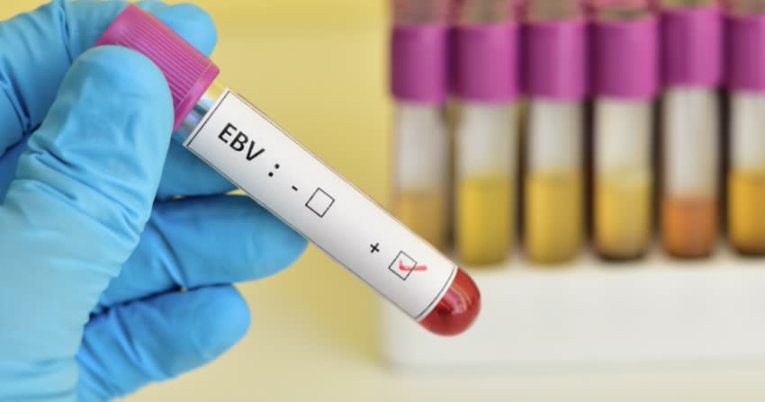 Mononucleosi e stanchezza: tutto quello che c’è da sapere
