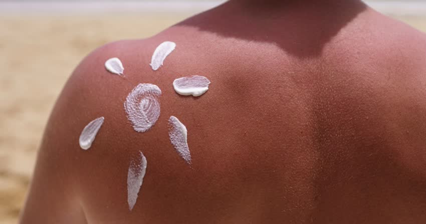 Eritema solare: come riconoscerlo, curarlo e prevenirlo