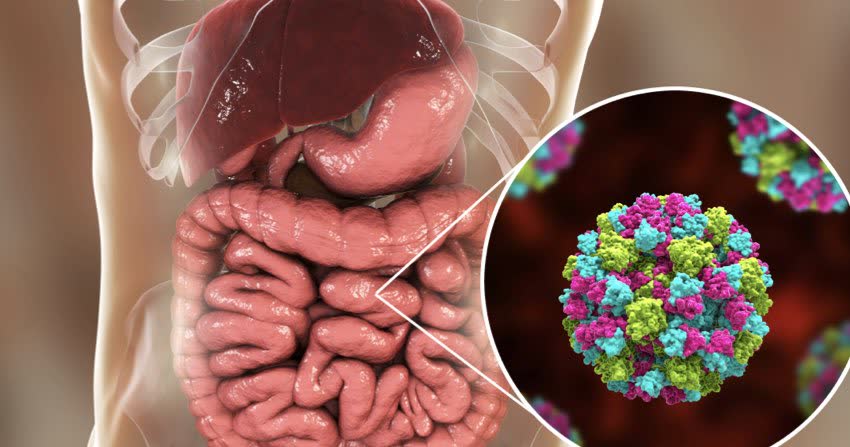 Gastroenterite virale: cause, sintomi, cura dell’influenza intestinale