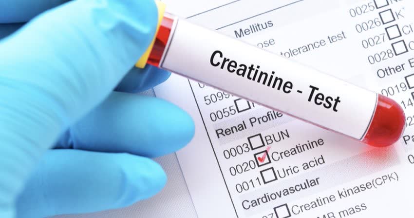 Capire la creatinina nell'insufficienza renale