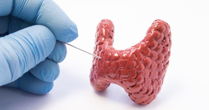 Agoaspirato tiroide: come funziona, risultati e effetti collaterali