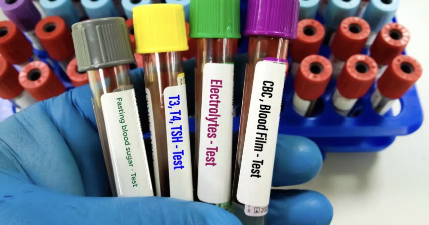 Esami per la tiroide: quali sono e come interpretarli?