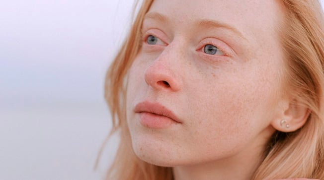 Efelidi: cosa sono e perché compaiono sulla pelle